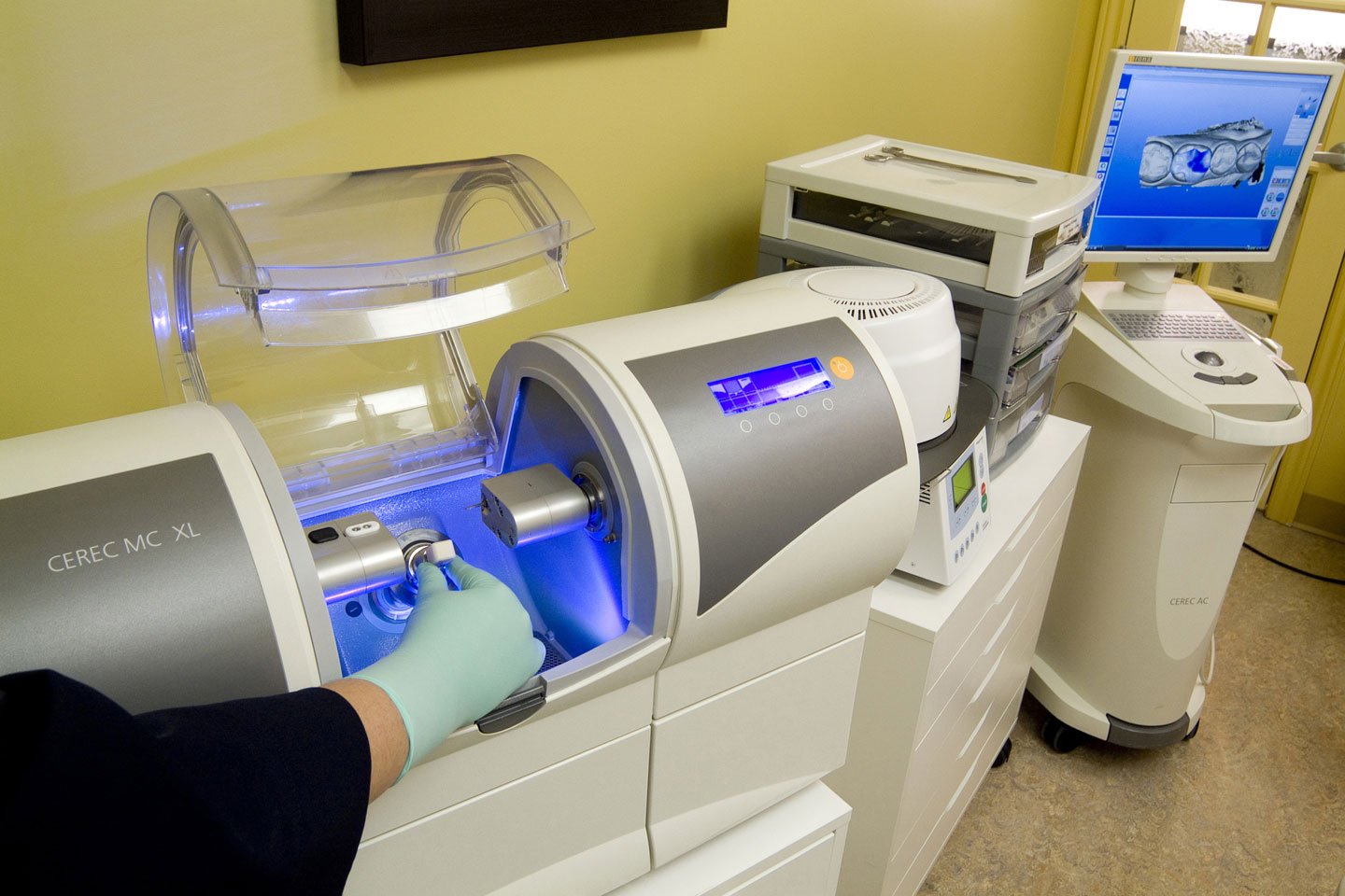 CEREC Technology in Huntersville, NC | Kreeb Family Dentistry